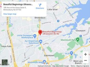 Directions to Ultrasound Clinic Near Me in Shrewsbury, NJ