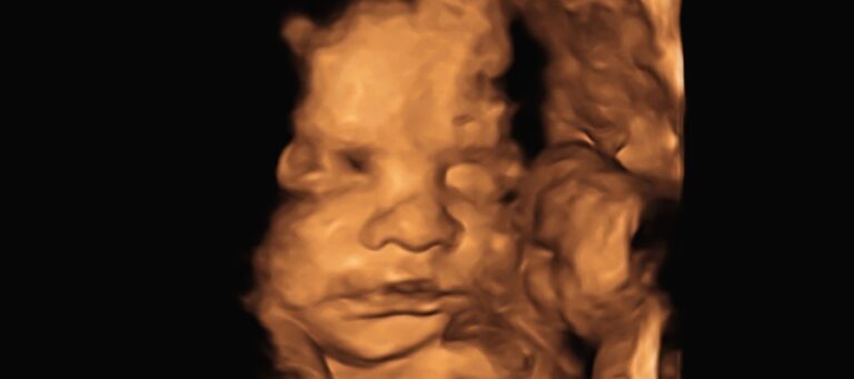 What to Expect from Your First 3D Sonogram